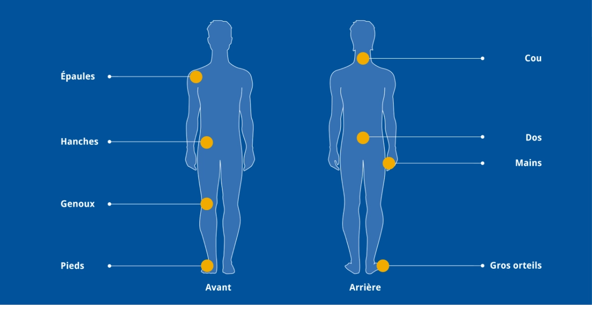 Qu’est-ce que l’arthrose?